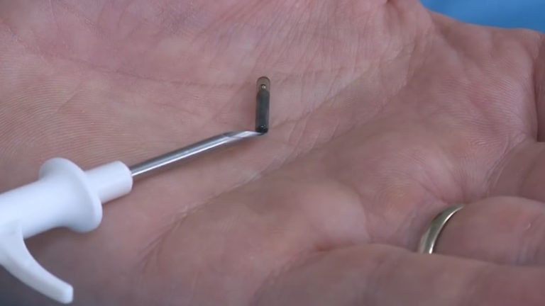 La tecnología subcutánea y el futuro de los chips implantados debajo de ...